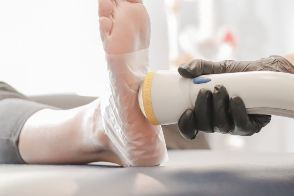 Shockwave Therapy - Apollo Wave - Charleston - Mount Pleasant